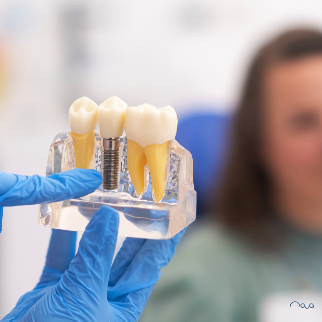 Want A Permanent Fix For Tooth Loss? Choose Dental Implants - Denpure ...