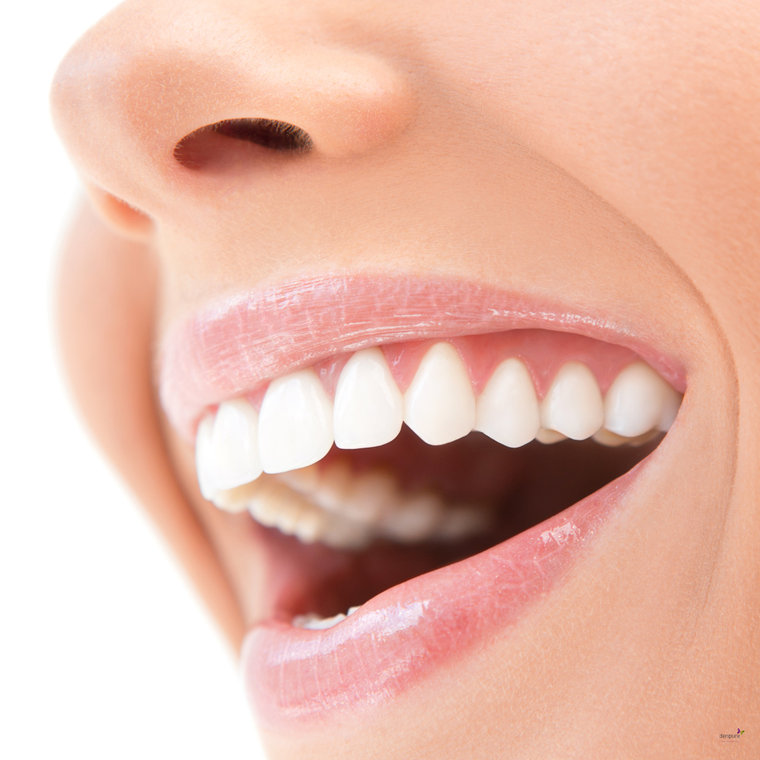 Is Composite Bonding Permanent? - Denpure Dental Care & Implant Centre ...